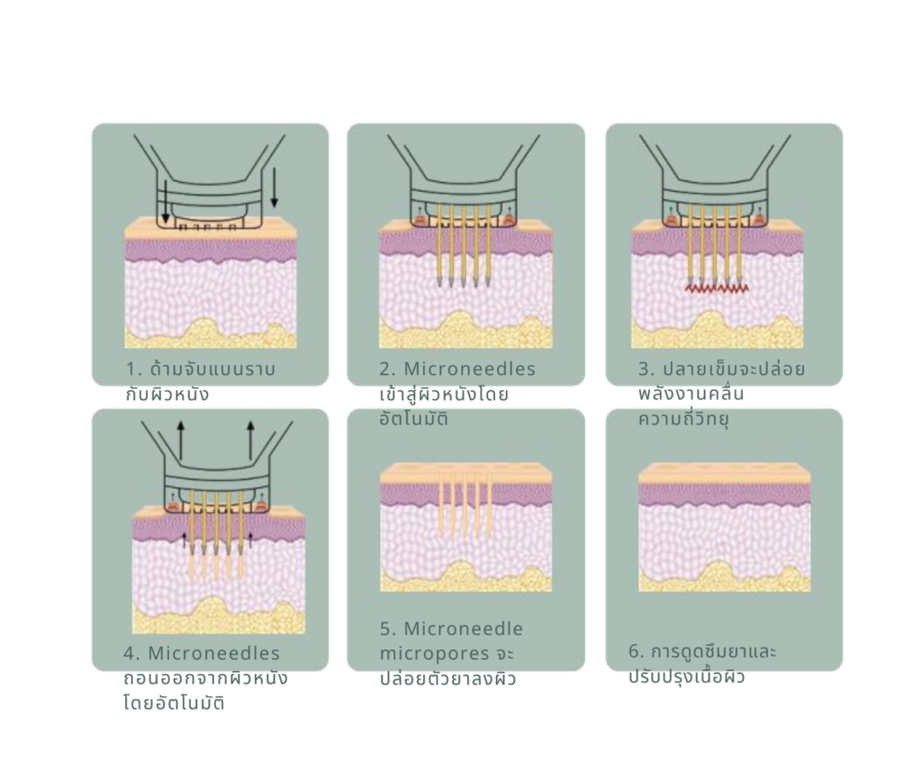 Derma Shine – MDC Aesthetics – จัดจำหน่ายและนำเข้าเครื่องสำอางส์ และ ...